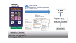 2021 WHO CLASSIFICATION OF CNS TUMORS.pptx