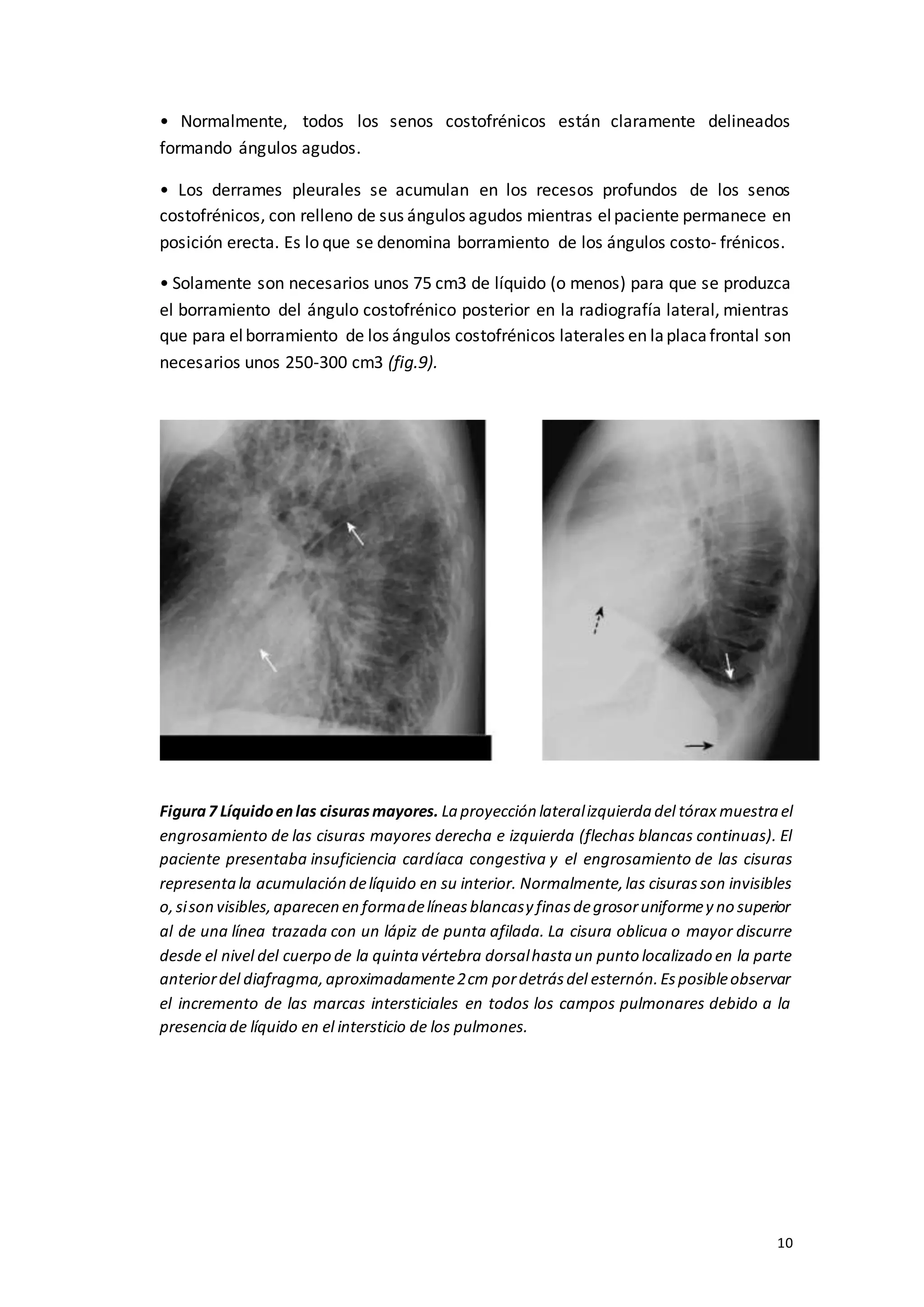 (2022 03-08) radiografia de torax (doc) | DOCX