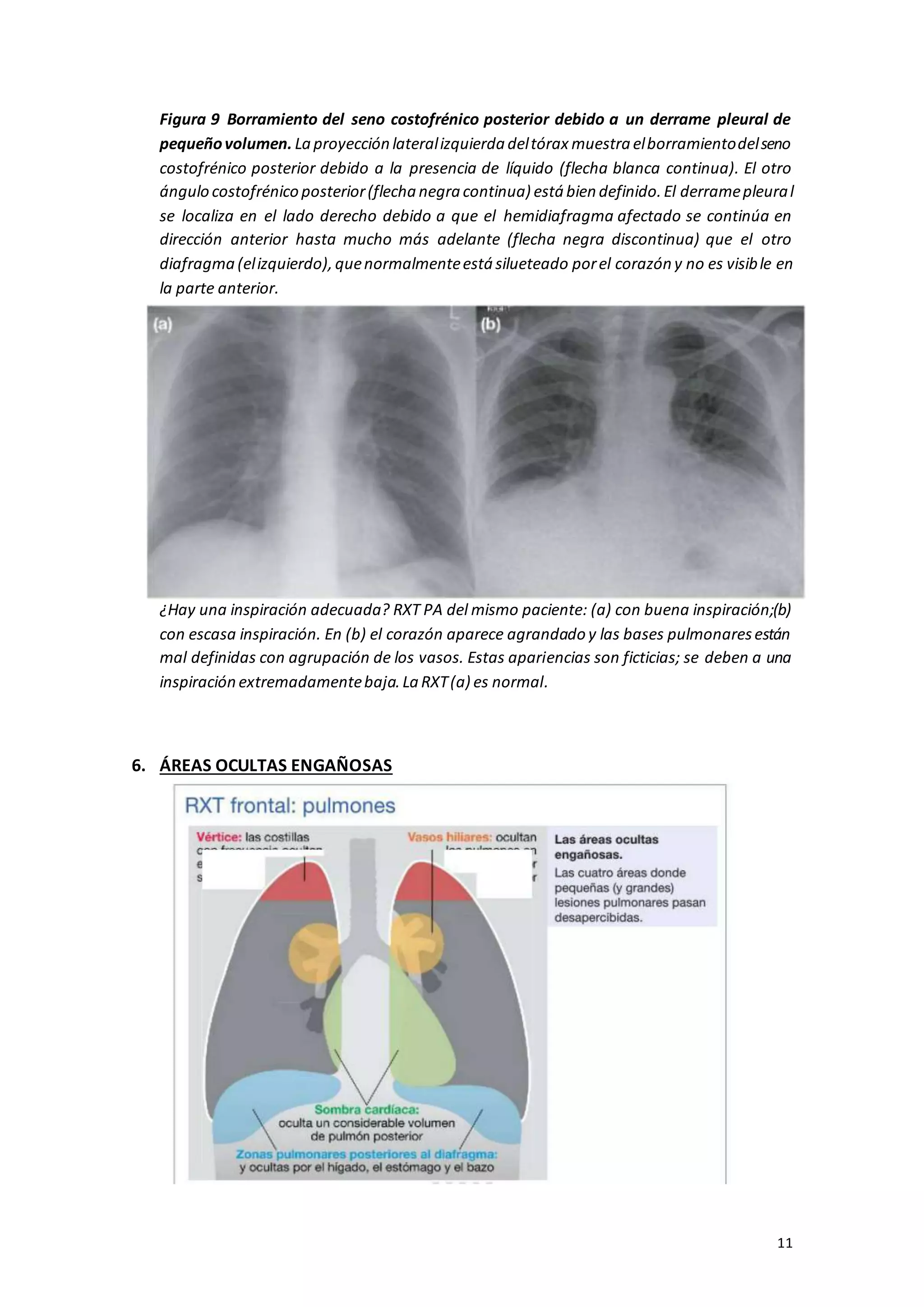 (2022 03-08) radiografia de torax (doc) | DOCX