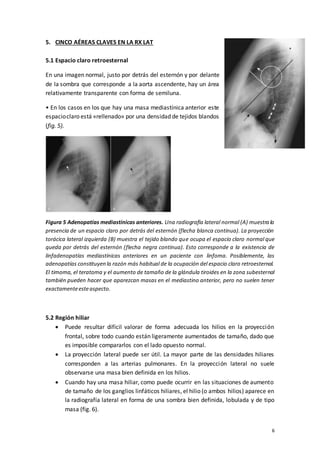 (2022 03-08) radiografia de torax (doc) | PDF