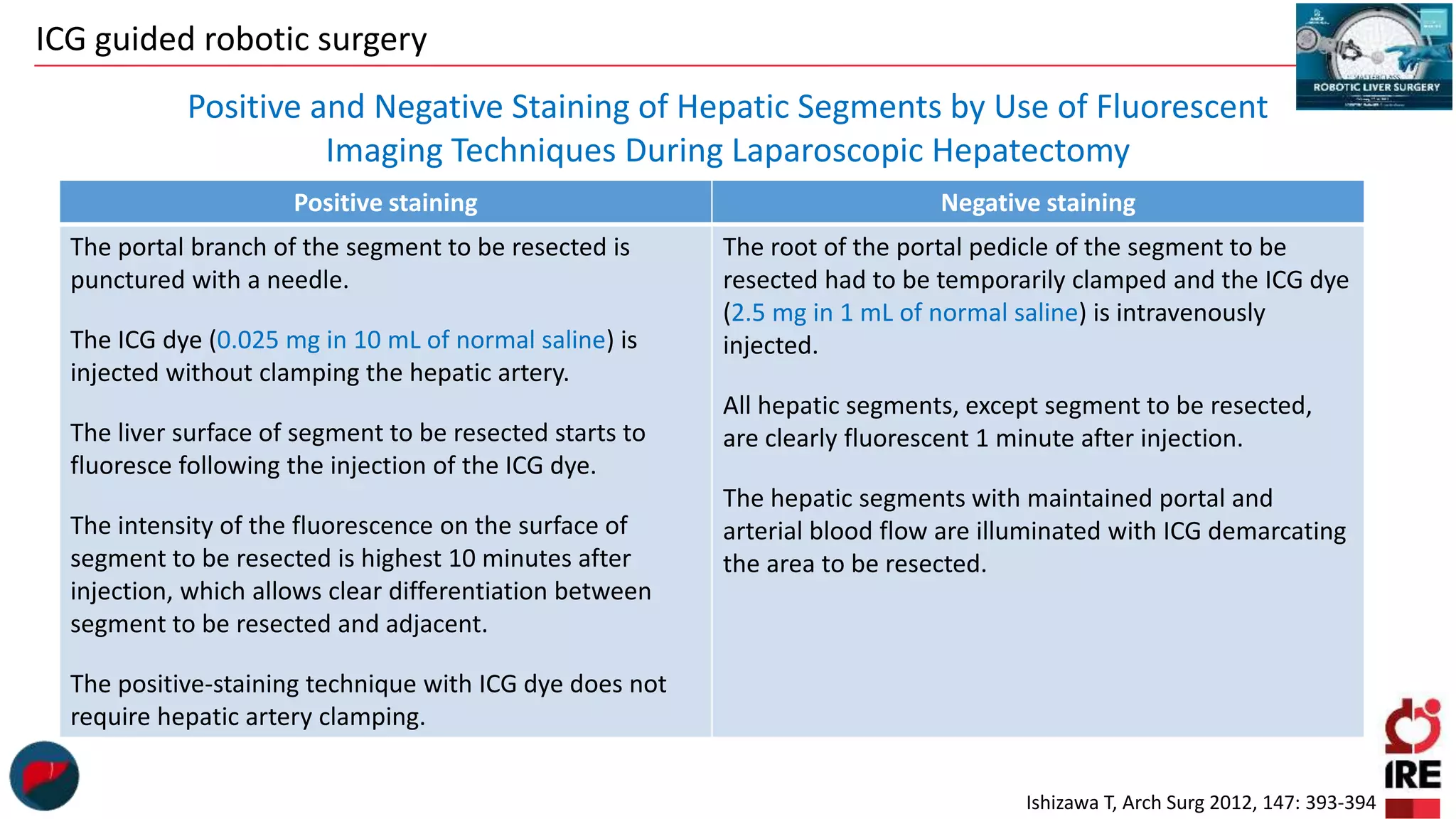 ICG guided robotic liver surgery | PPTX