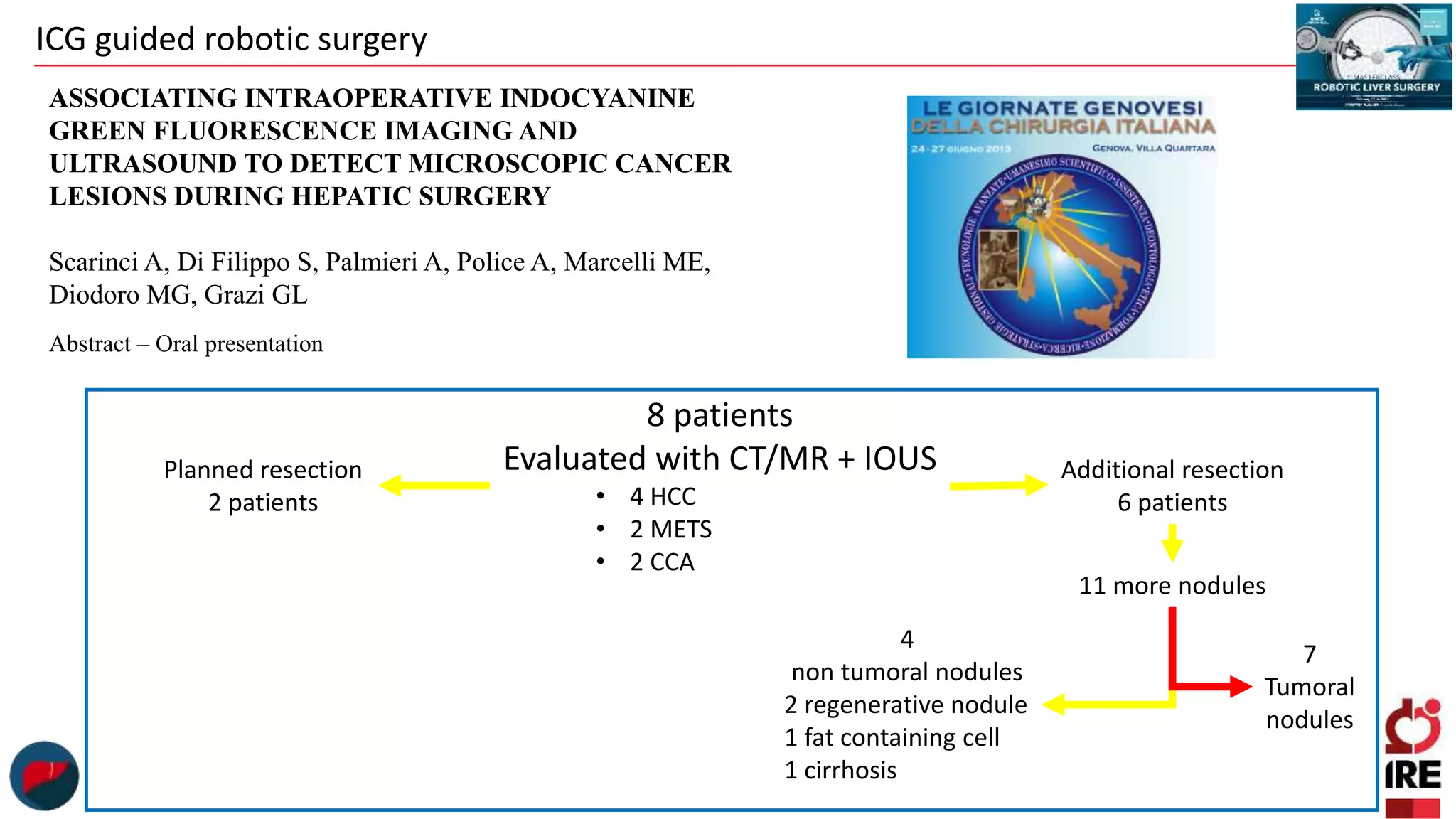 ICG guided robotic liver surgery | PPTX