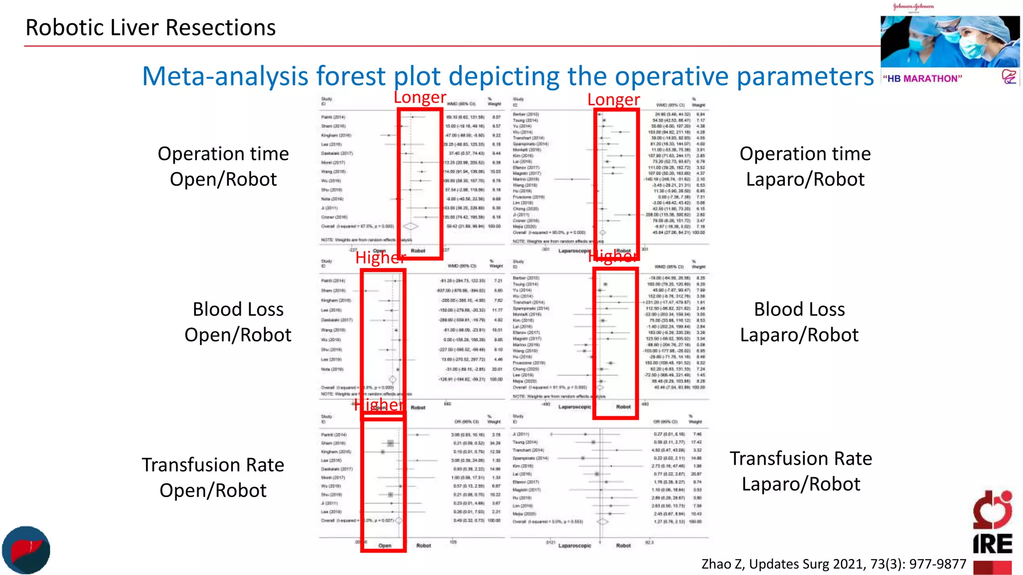 State of the art of robotic surgery in the liver | PPTX