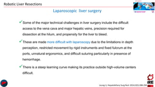 State of the art of robotic surgery in the liver | PPT