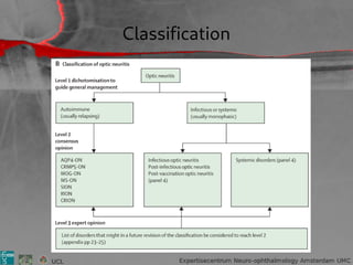 Optic Neuritis: diagnosis and classification 2022 | PDF