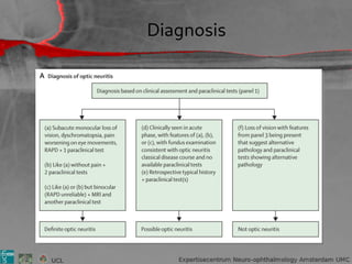 Optic Neuritis: diagnosis and classification 2022 | PDF