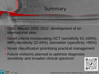 Optic Neuritis: diagnosis and classification 2022 | PDF