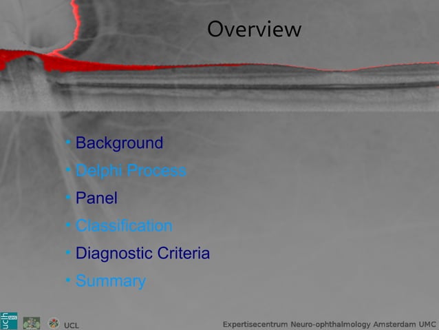 Optic Neuritis: diagnosis and classification 2022 | PDF