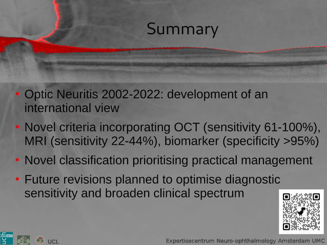 Optic Neuritis: diagnosis and classification 2022