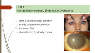 2022_0424_Bullous Keratopathy.ppt