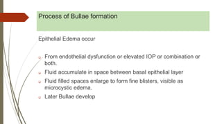 2022_0424_Bullous Keratopathy.ppt