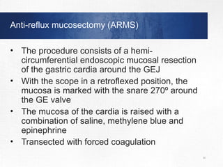 General surgery for gastroesophageal Reflux Disease | PPTX