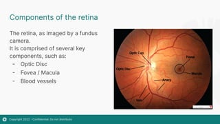 Using Artificial Intelligence for Detection of Systemic Diseases in Retinal Images | PDF | Eye ...