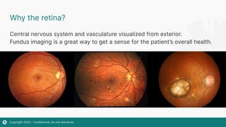 Using Artificial Intelligence for Detection of Systemic Diseases in Retinal Images | PDF | Eye ...