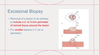 Principles of Differential Diagnosis and Biopsy | PPTX