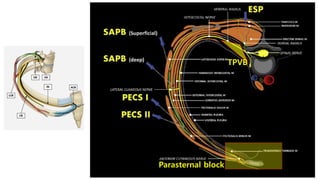 2022 KSCTVA Sono-guided nerve blocks for cardio-thoracic surgery.pptx