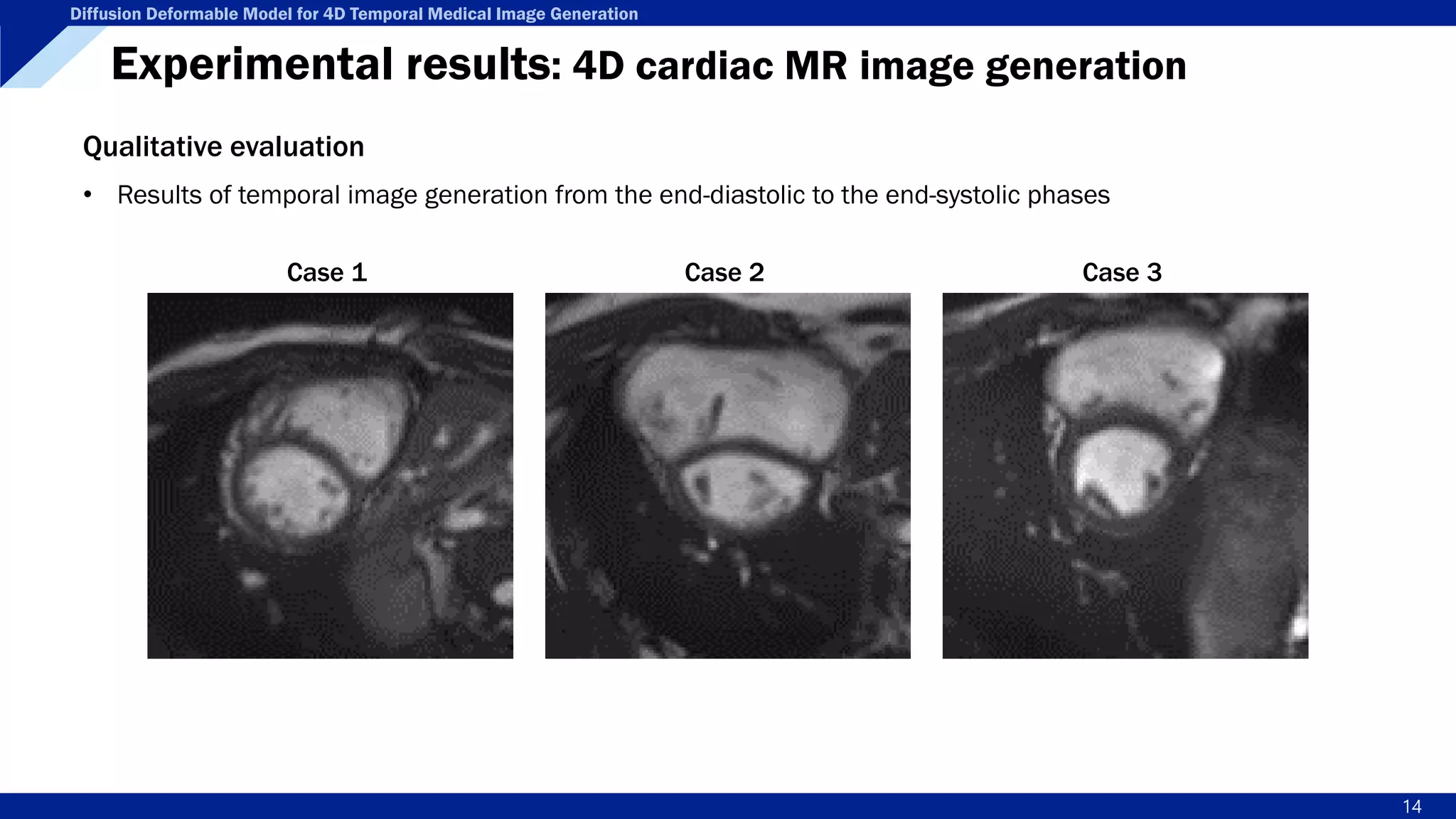 Diffusion Deformable Model for 4D Temporal Medical Image Generation | PDF | 3-D Graphics ...