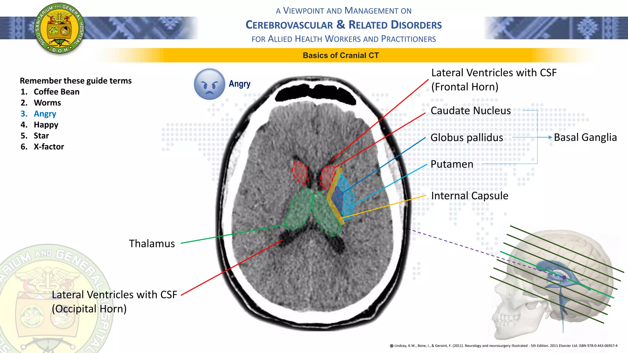2022 Stroke Lecture (Updated Guidelines).pdf