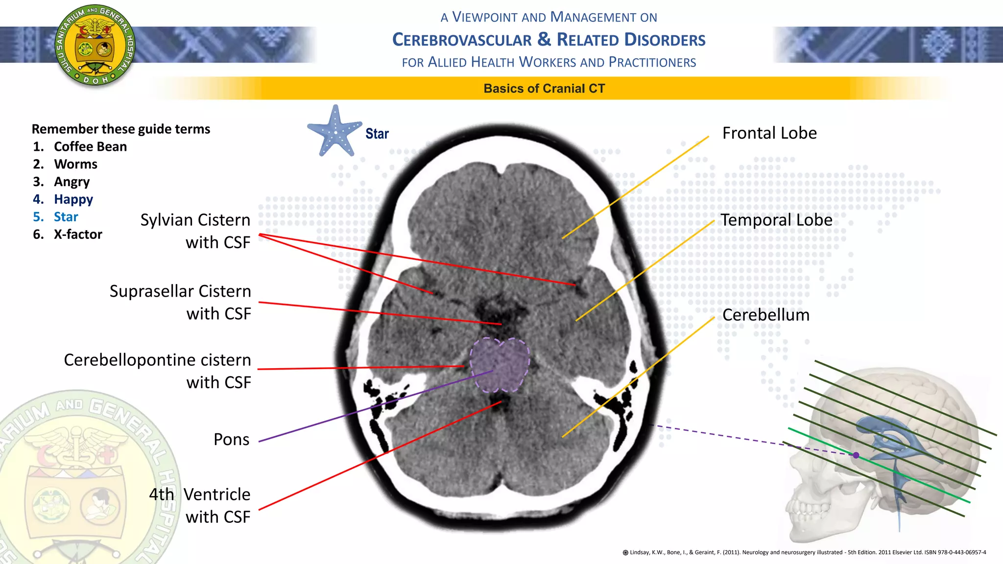 2022 Stroke Lecture (Updated Guidelines).pdf