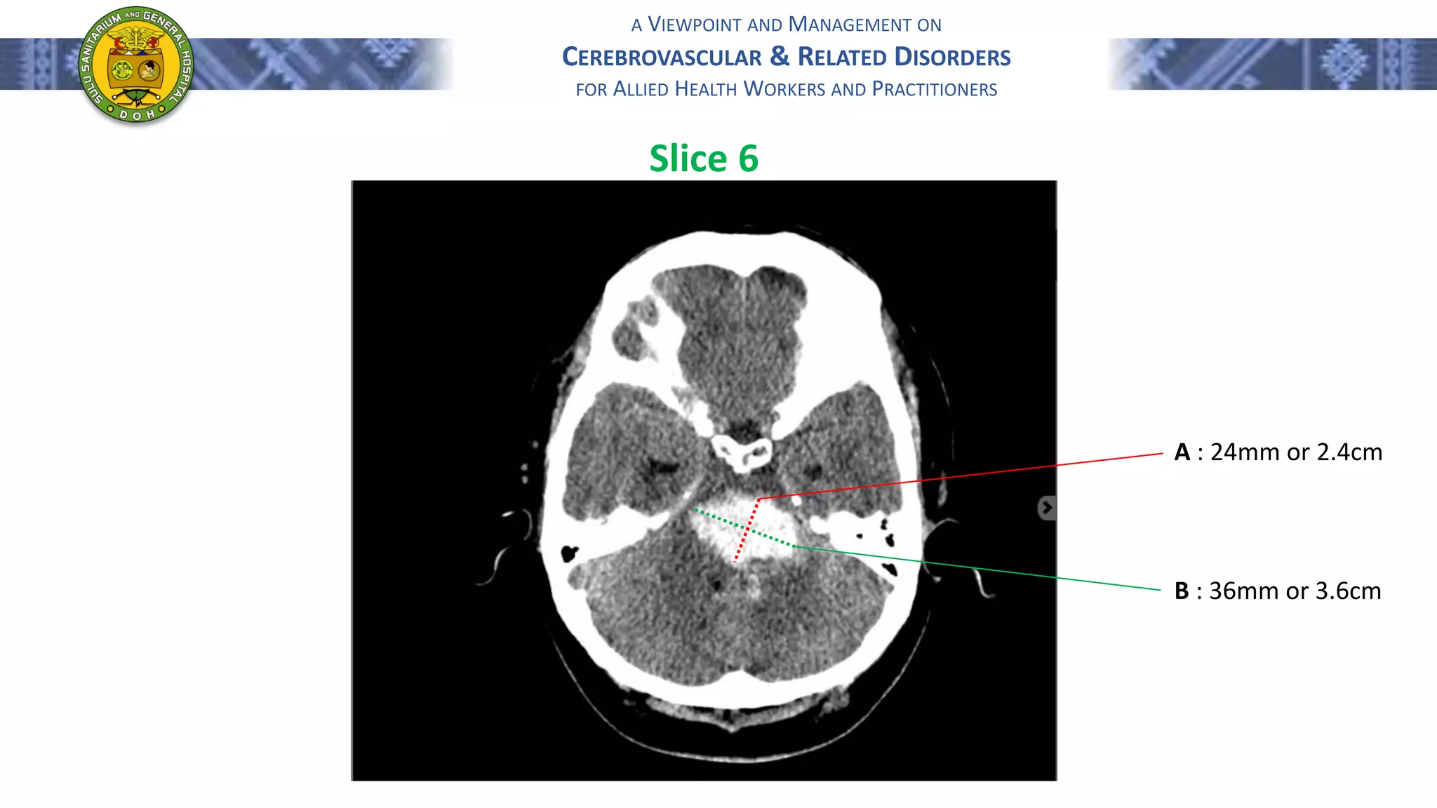 2022 Stroke Lecture (Updated Guidelines).pdf