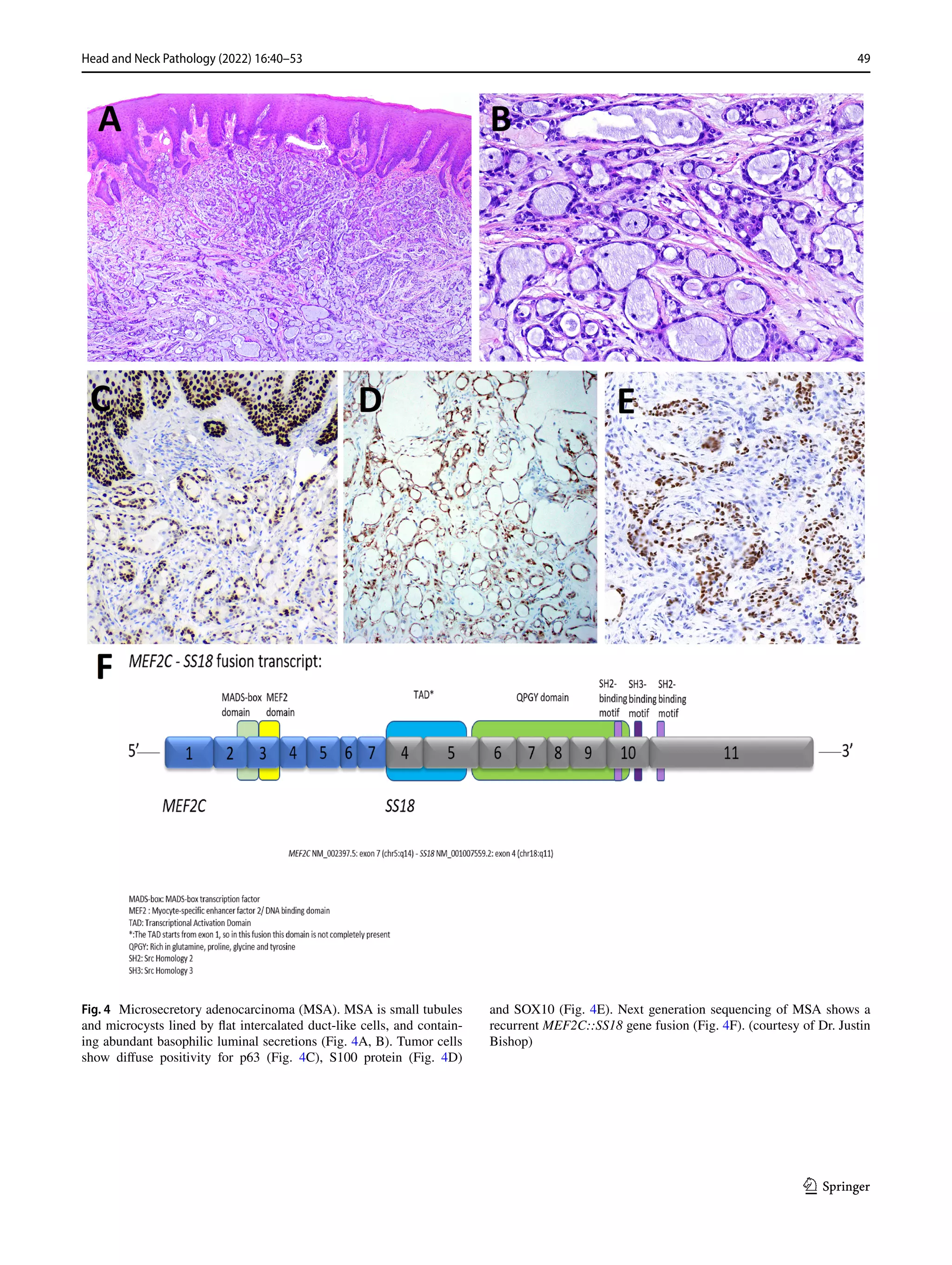 2022 WHO Salivary gland tumors update.pdf