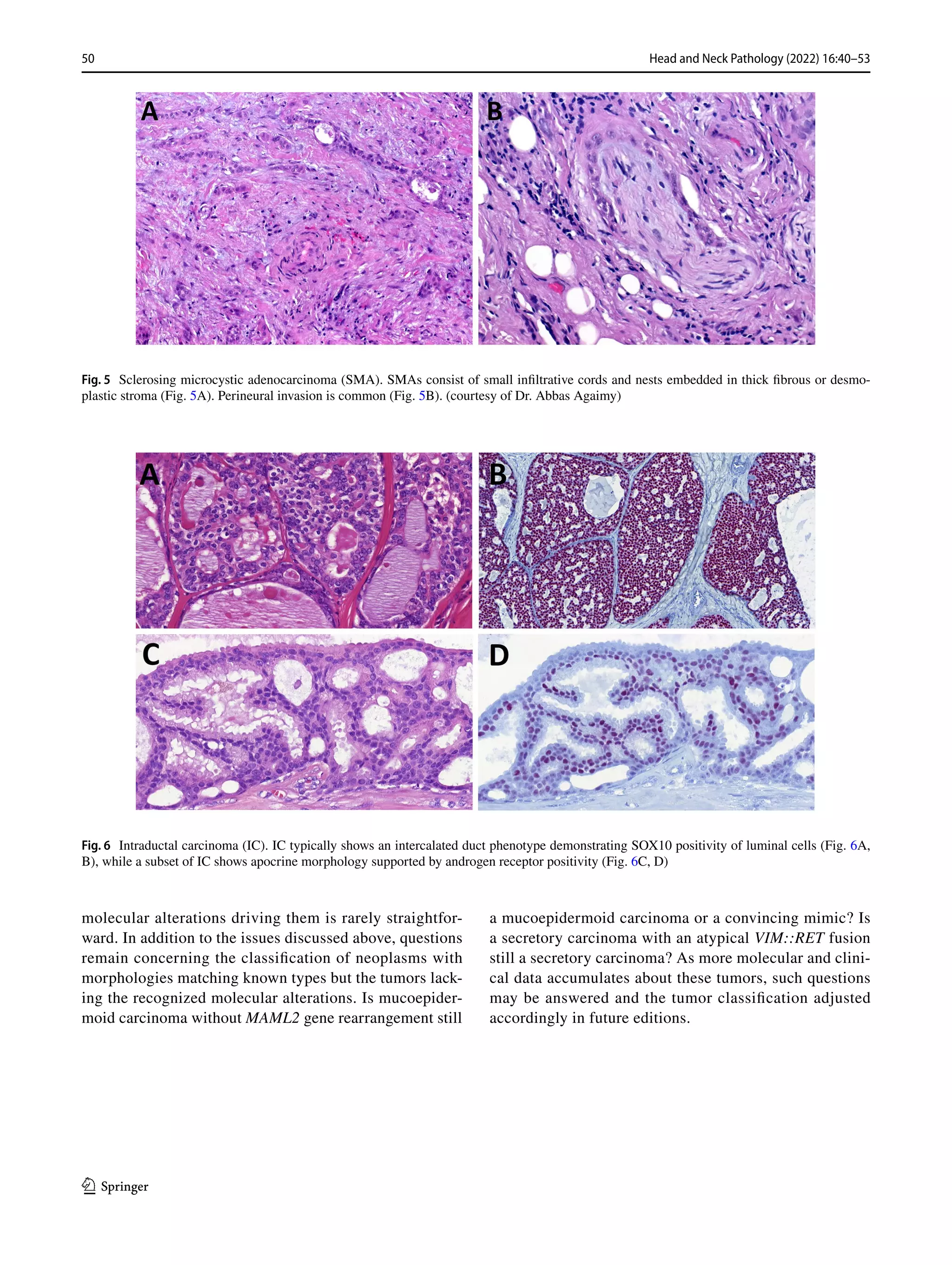 2022 WHO Salivary gland tumors update.pdf