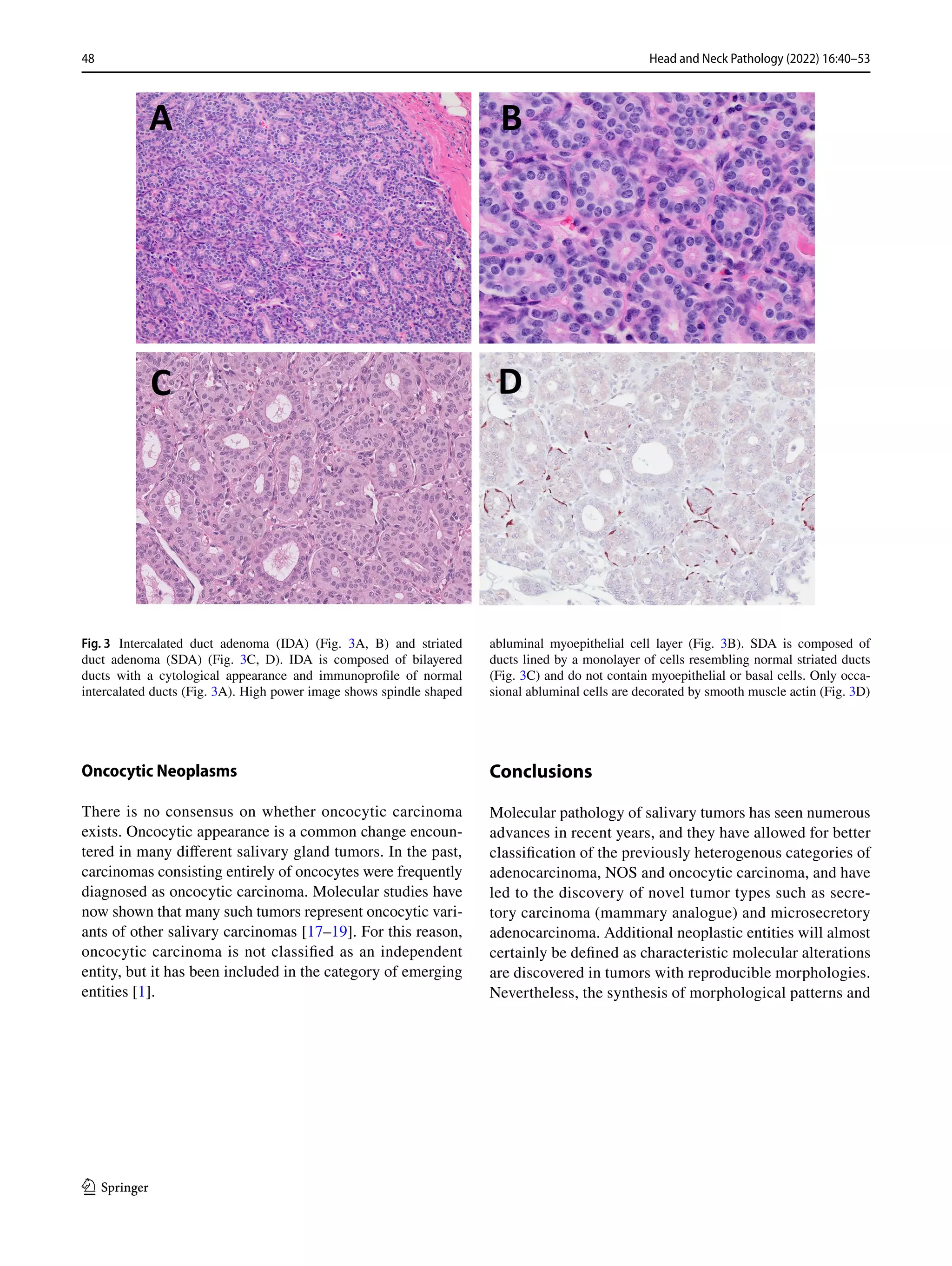 2022 WHO Salivary gland tumors update.pdf