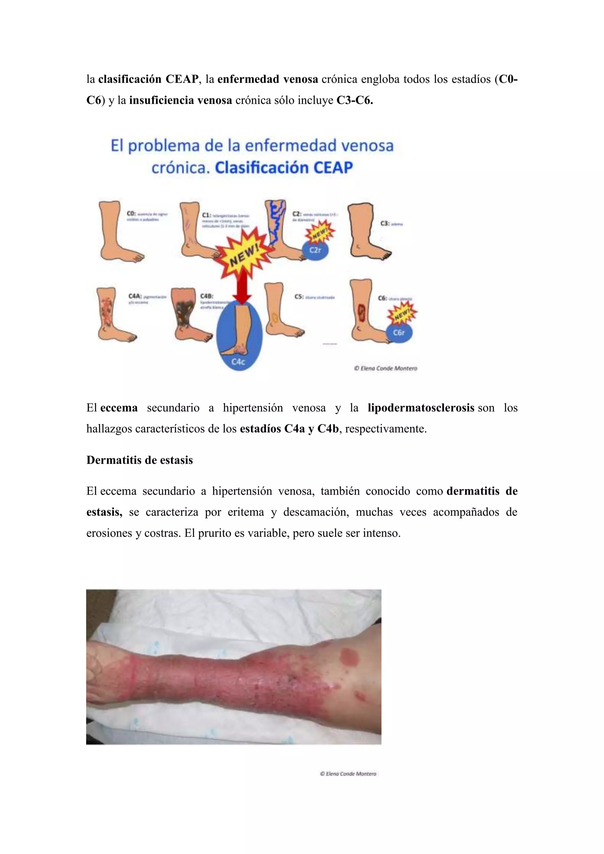 (2023-02-15)TERAPIACOMPRESIVA (doc).docx