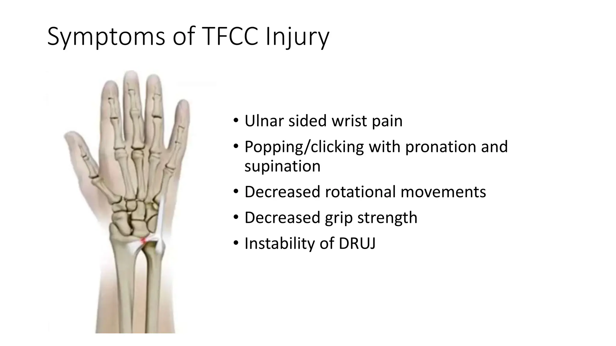 TRIANGULAR FIBROCARTILAGE COMPLEX, TFCC INJURY , DR ARJUN , | PPTX