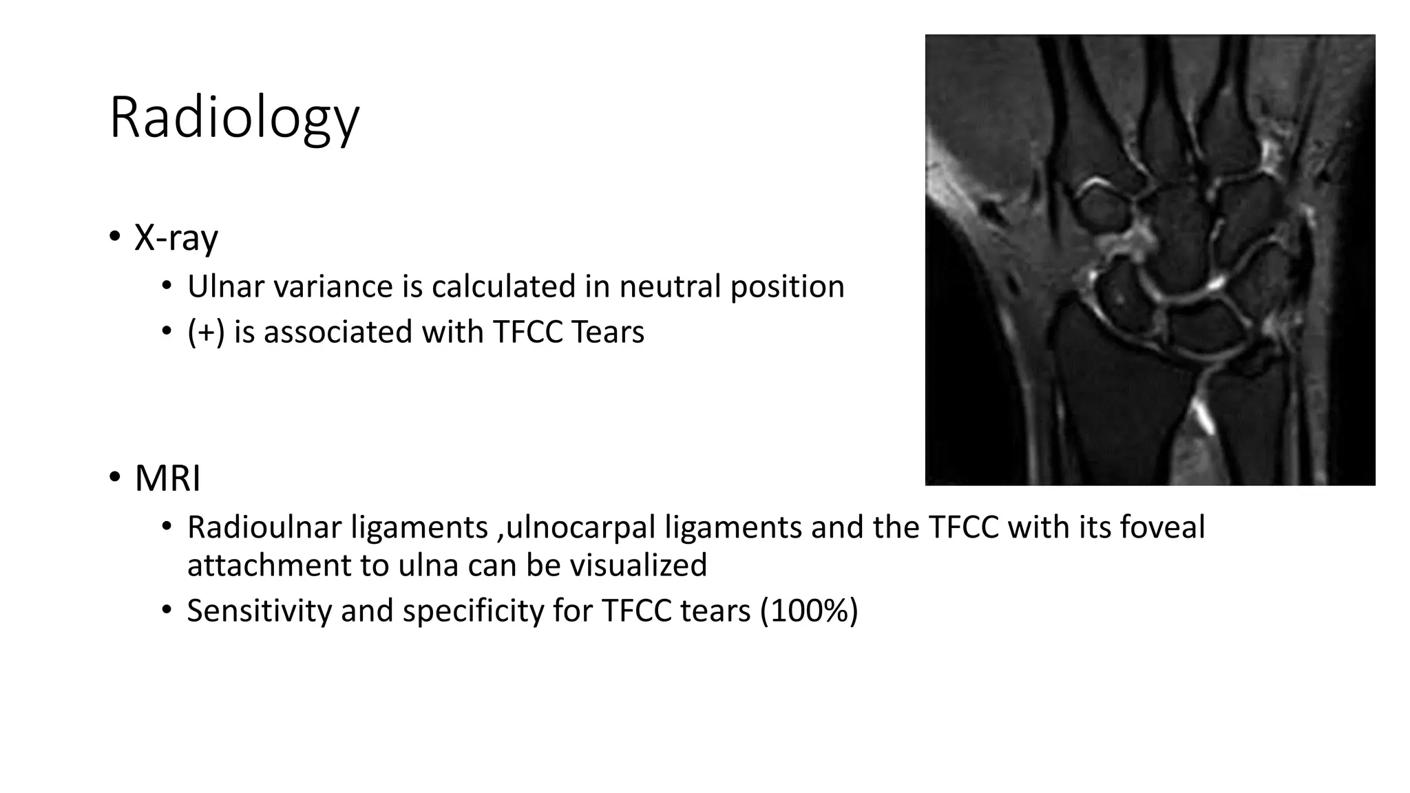 TRIANGULAR FIBROCARTILAGE COMPLEX, TFCC INJURY , DR ARJUN , | PPTX