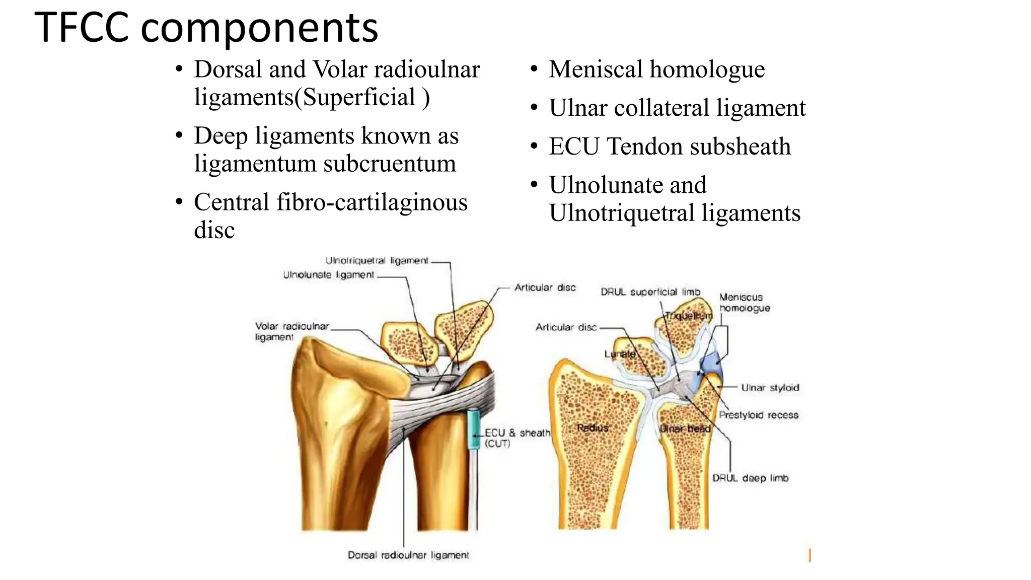 TRIANGULAR FIBROCARTILAGE COMPLEX, TFCC INJURY , DR ARJUN , | PPTX