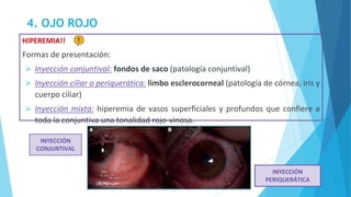 (2023-05-11) Patología oftalmológica en AP (PPT).pptx