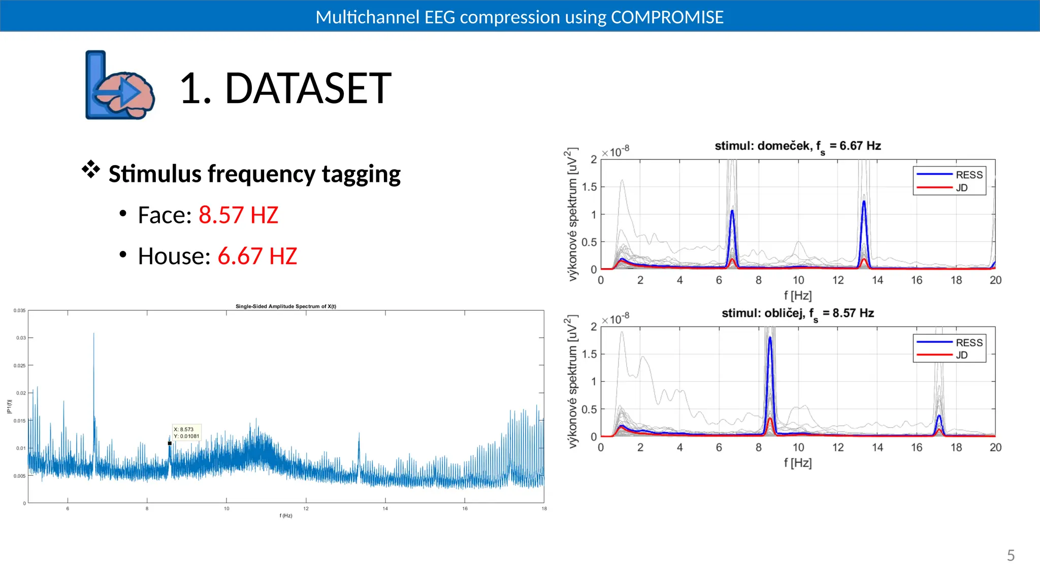 Eeg Signal Processing For Eeg Signal Processing Ppt