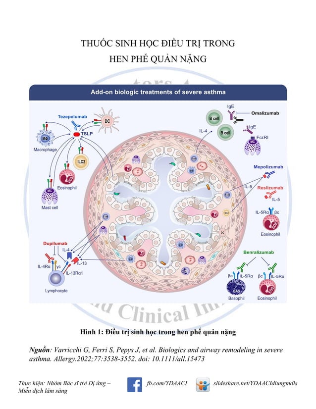 Thuốc sinh học điều trị trong hen phế quản | PDF