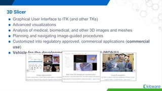 ITK, 3D Slicer, MONAI: Creating and sustaining impact with open science ...