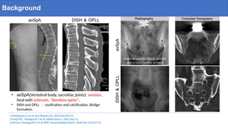 Yokohama OPLL DISH MOI LIEN QUAN GIUA HAI BENH | PPT