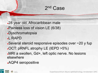 Hill Panitch lecture on Optic Neuritis | PPT