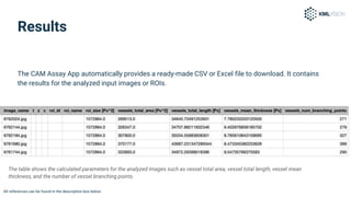 IKOSA Prisma in Action - Assessing angiogenesis hallmarks within the ...