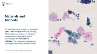 Simplifying N:C Ratio Analysis in Cytology: An Easy Approach Using ...