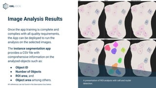Simplifying N:C Ratio Analysis in Cytology: An Easy Approach Using ...
