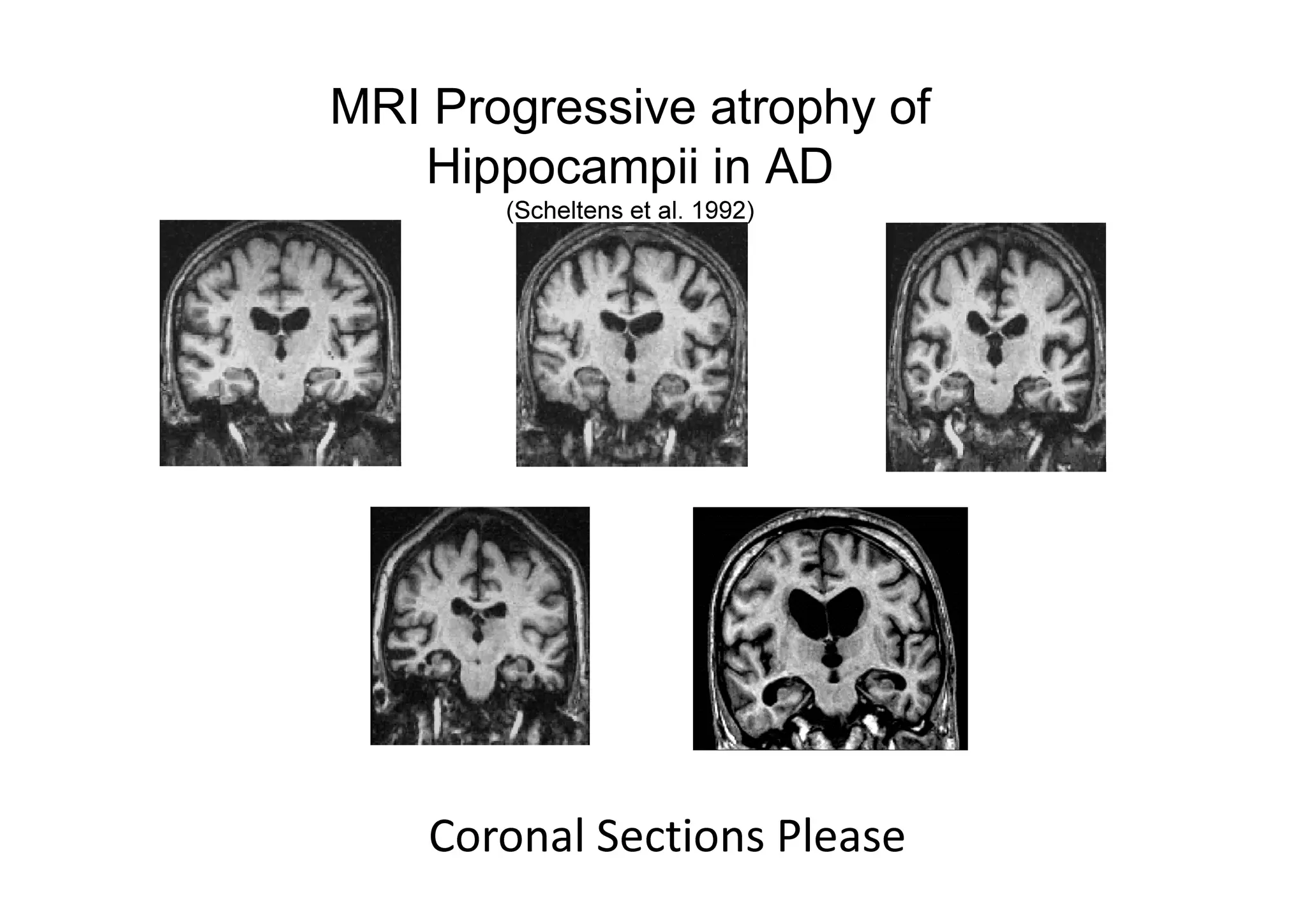 1120210-失智症的診斷與治療.pdf