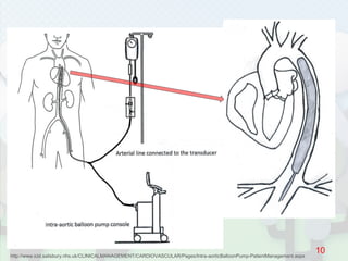 202303 IABP.pdf