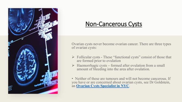 Types of Ovarian Cysts | PPTX