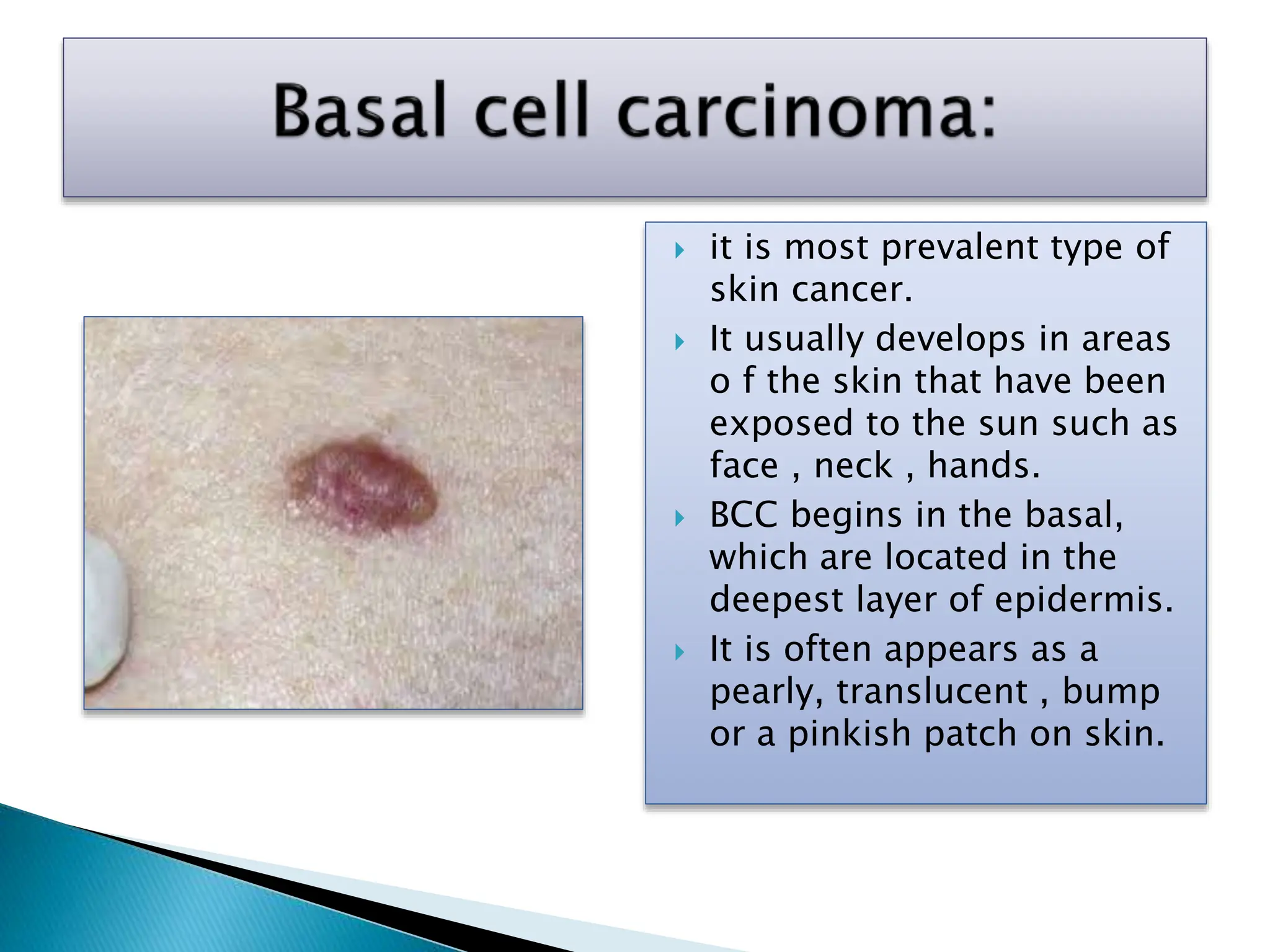 skin disorders.pptx