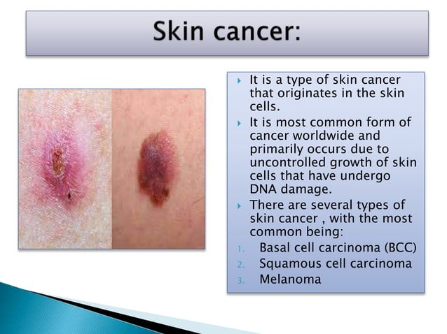 skin disorders.pptx