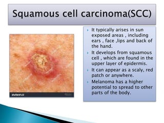 skin disorders.pptx