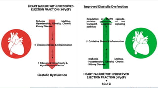 2023 ACC Expert Consensus heart failure hfref | PPTX