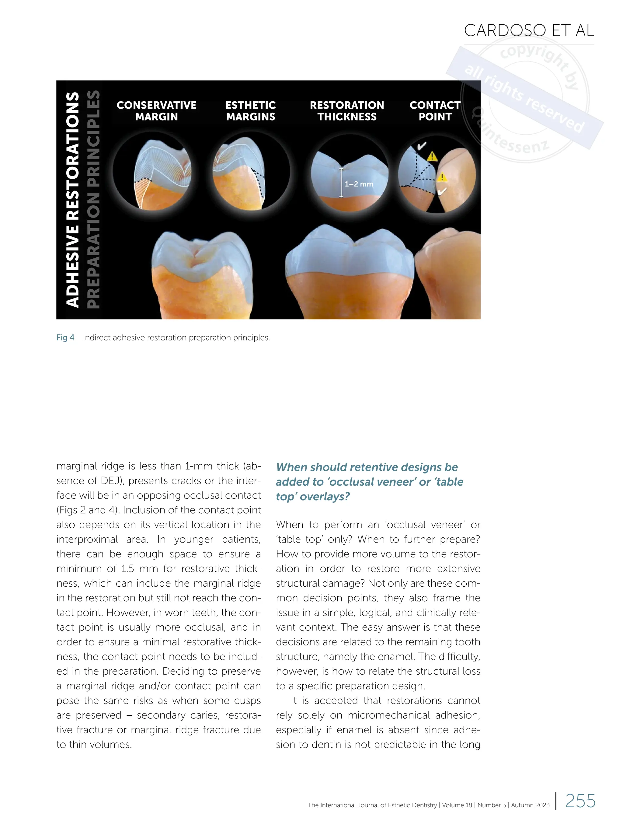 2023 Clinical guidelines for posterior restorations based on Coverage ...