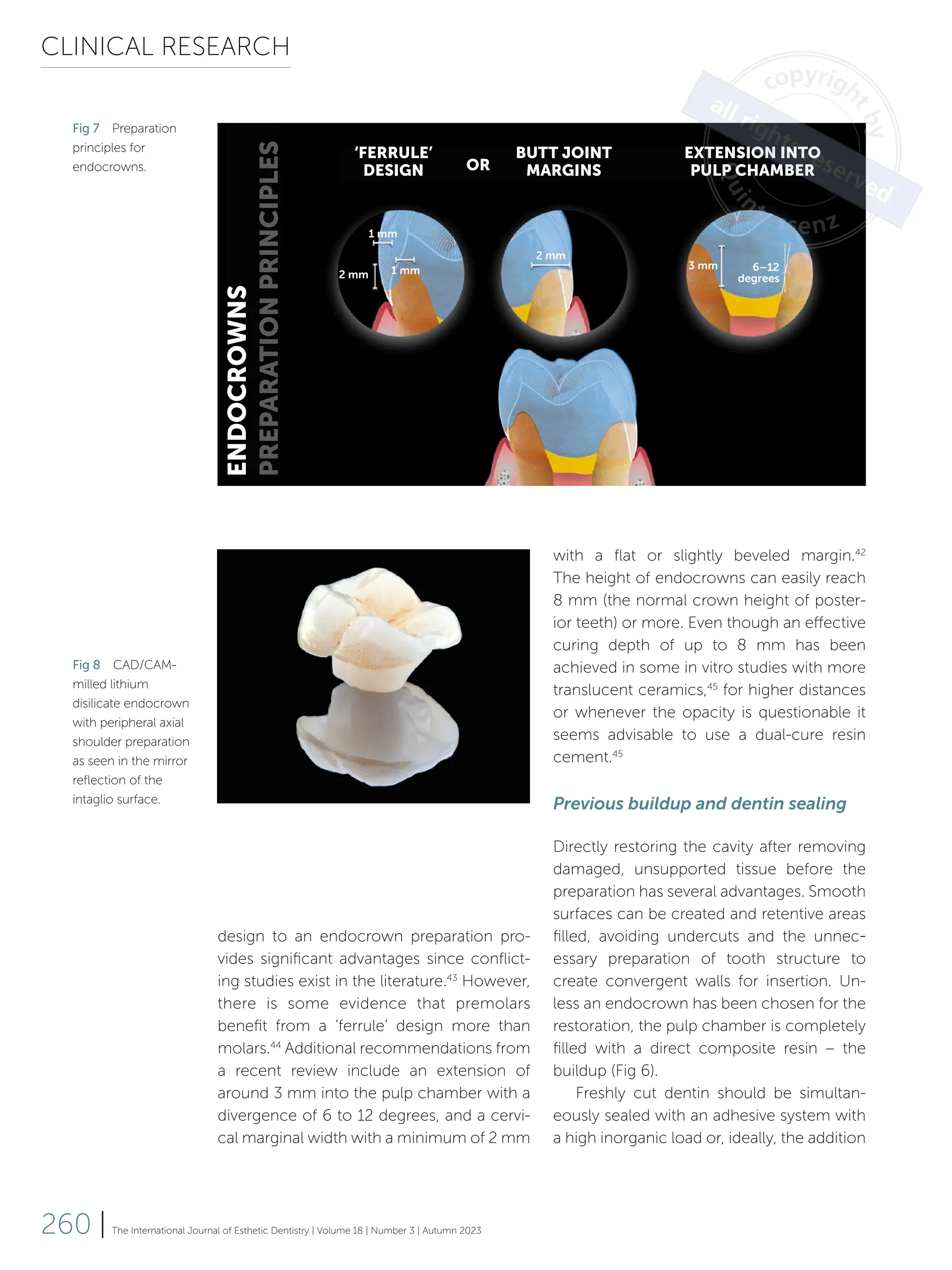 2023 Clinical guidelines for posterior restorations based on Coverage ...