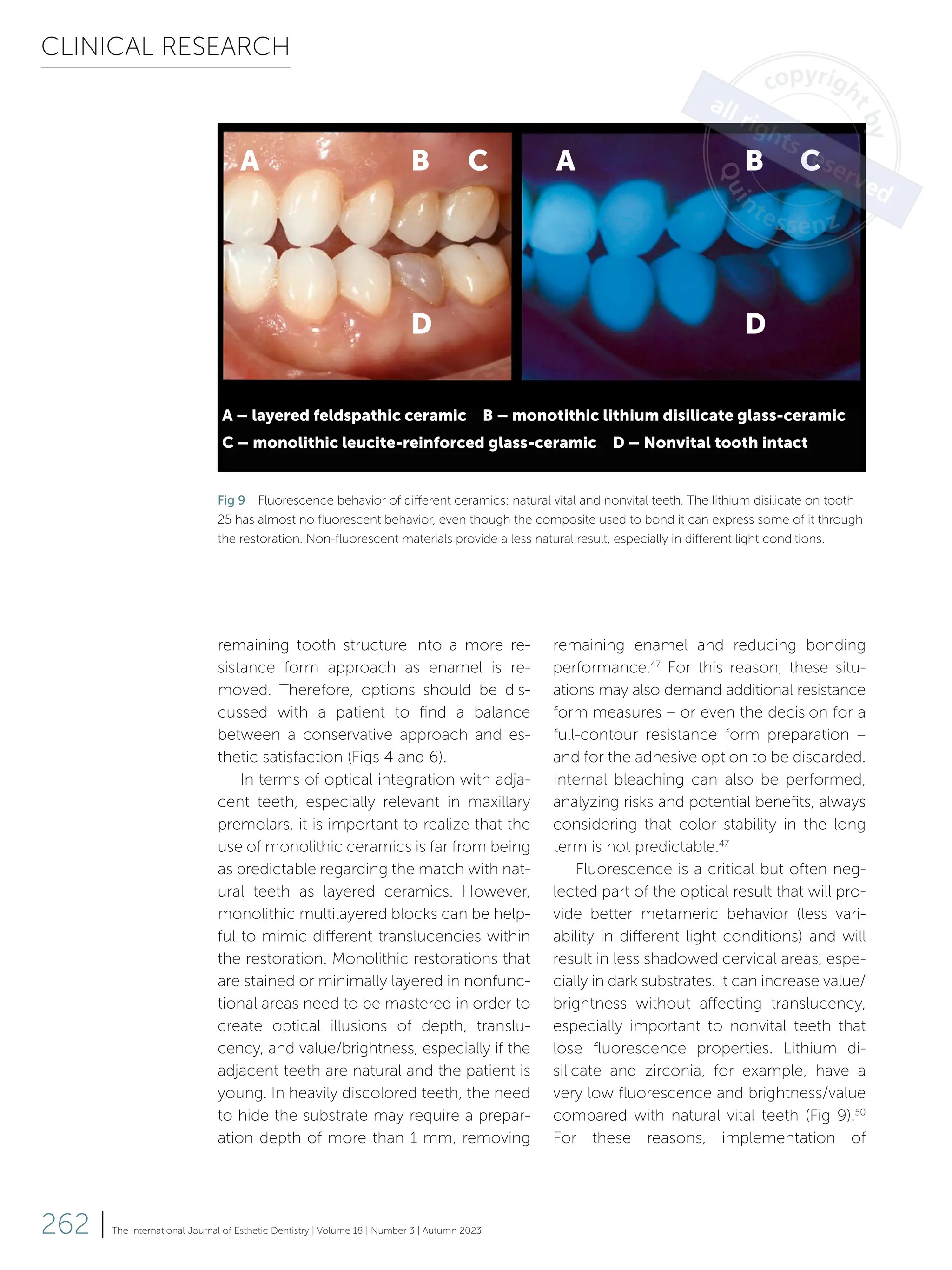 2023 Clinical guidelines for posterior restorations based on Coverage ...